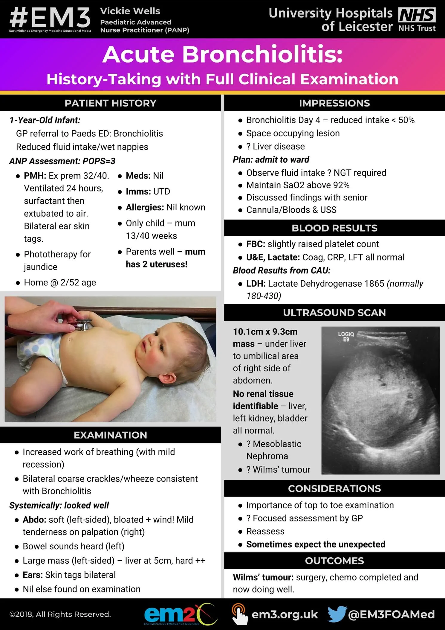 Acute Bronchiolitis