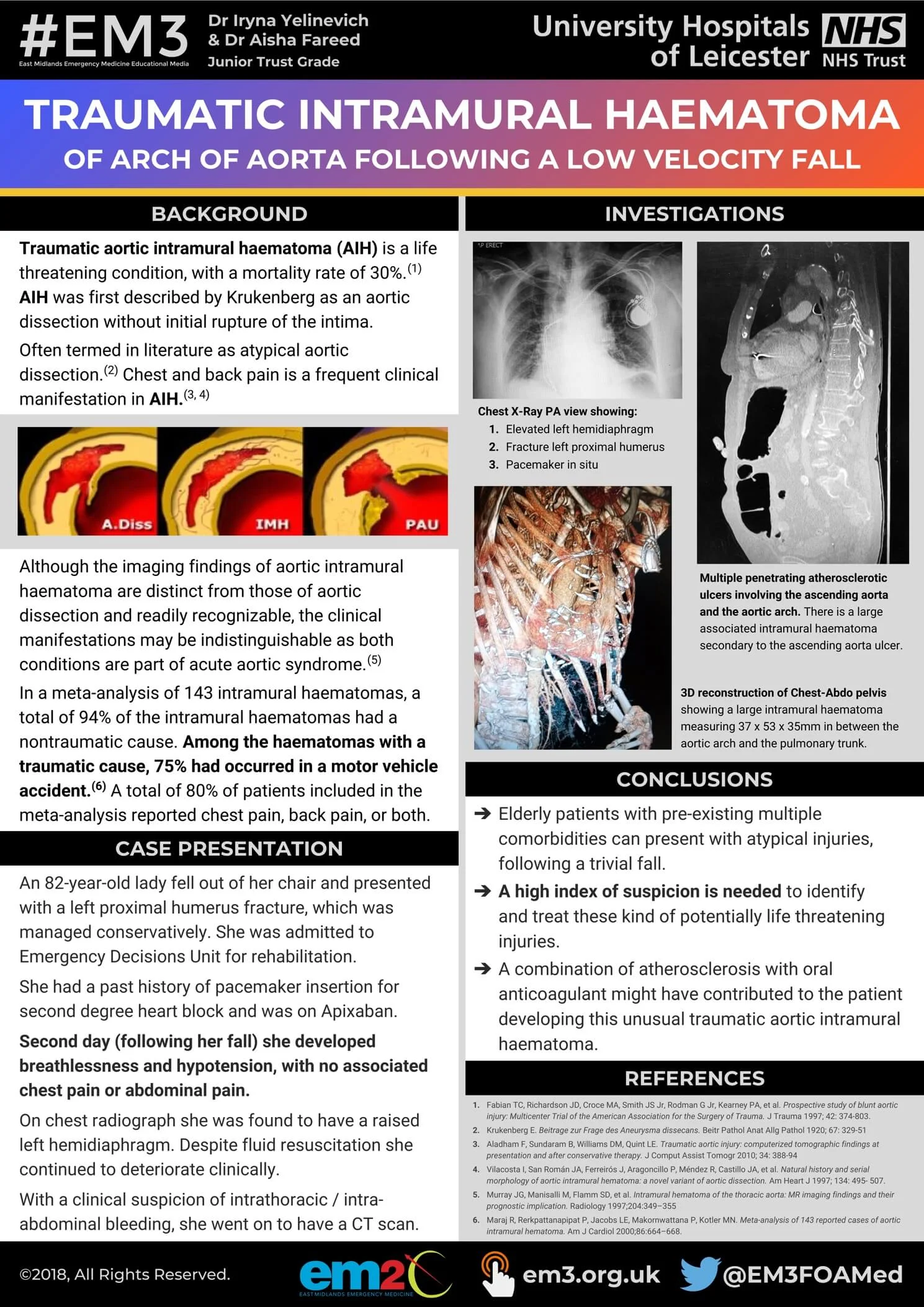 Traumatic Intramural Haematoma of Arch of Aorta Following a Low ...