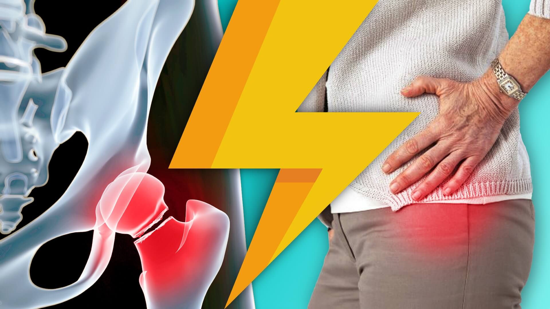 Lightning Learning: Hip Fractures — EM3