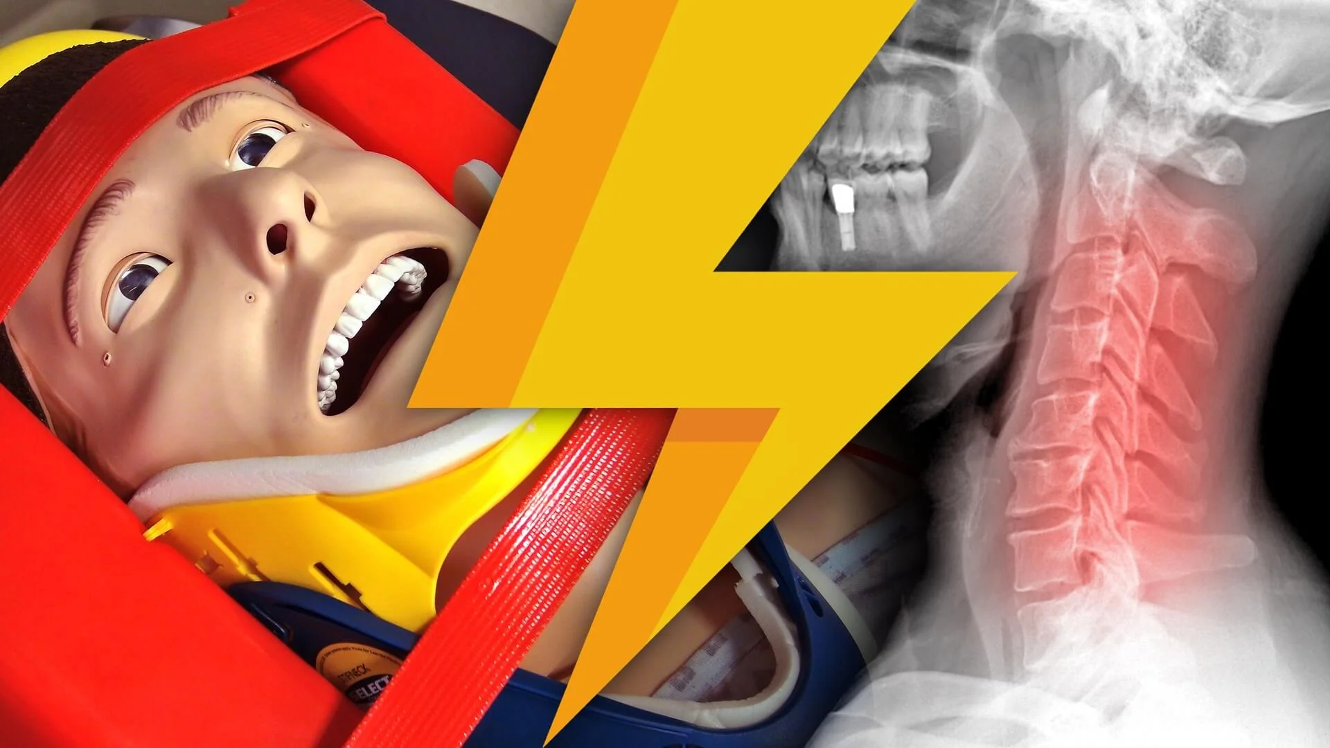 Lightning Learning: Pre-Tibial Laceration — EM3