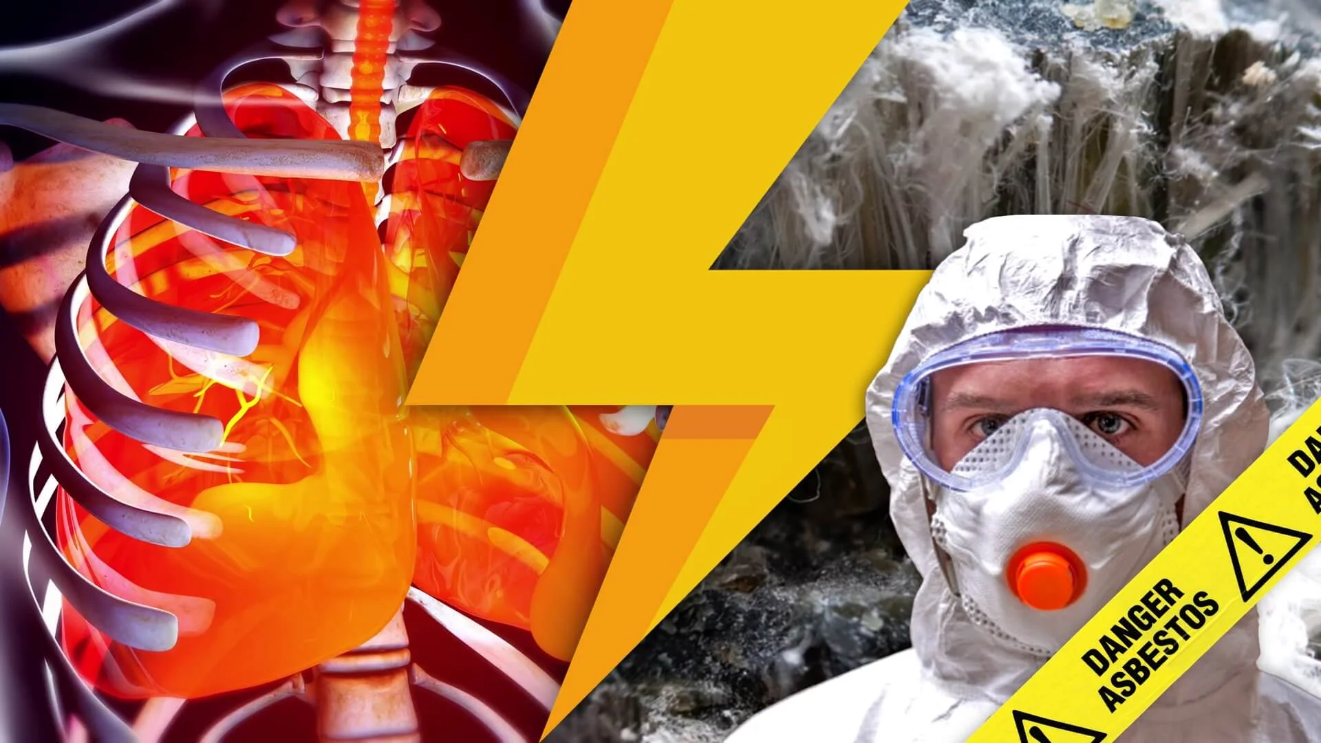 Lightning Learning: Life-Threatening Asthma — #EM3: East Midlands ...