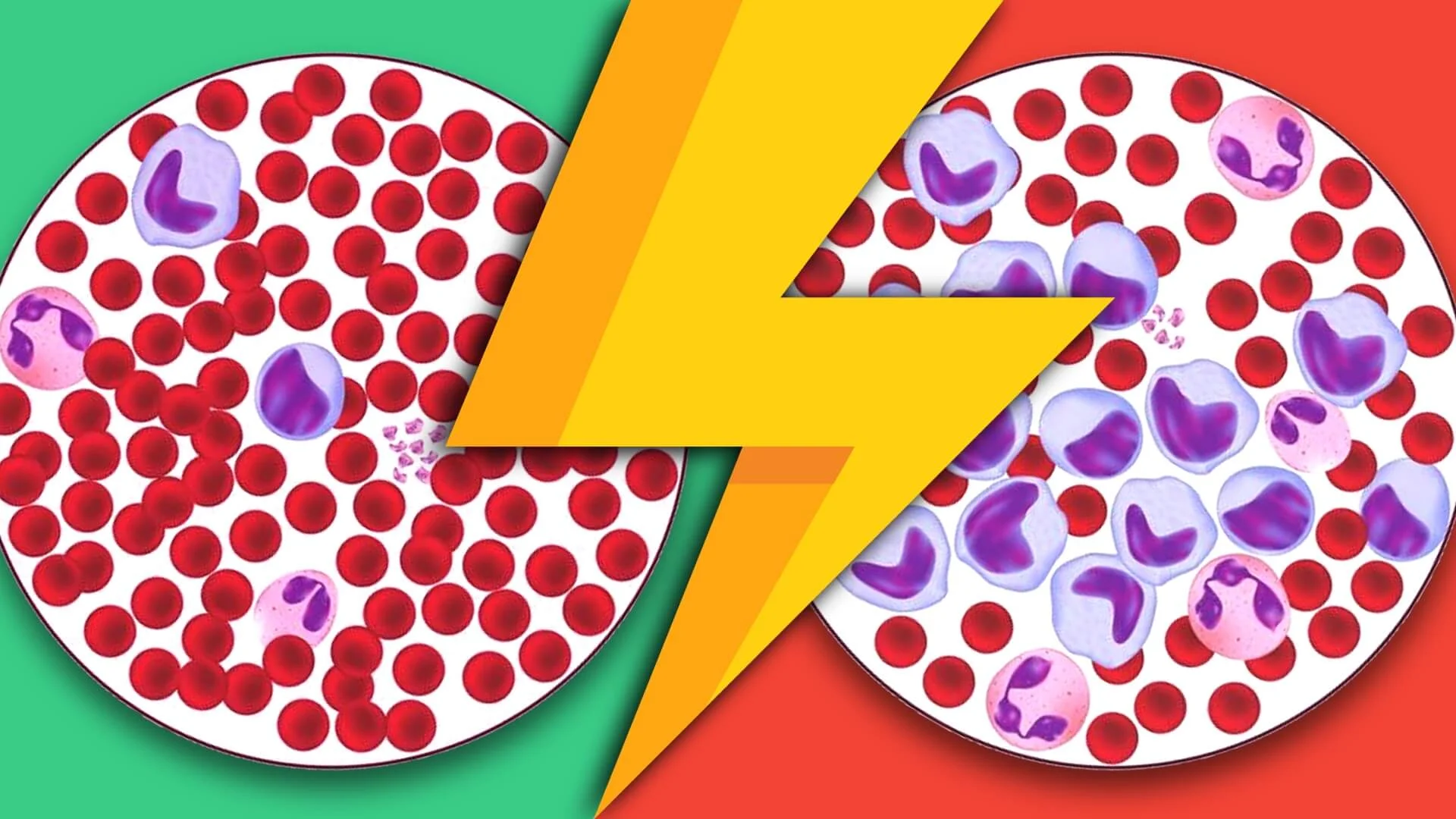 Lightning Learning: Acute Confusion & Red Flag Sepsis — EM3