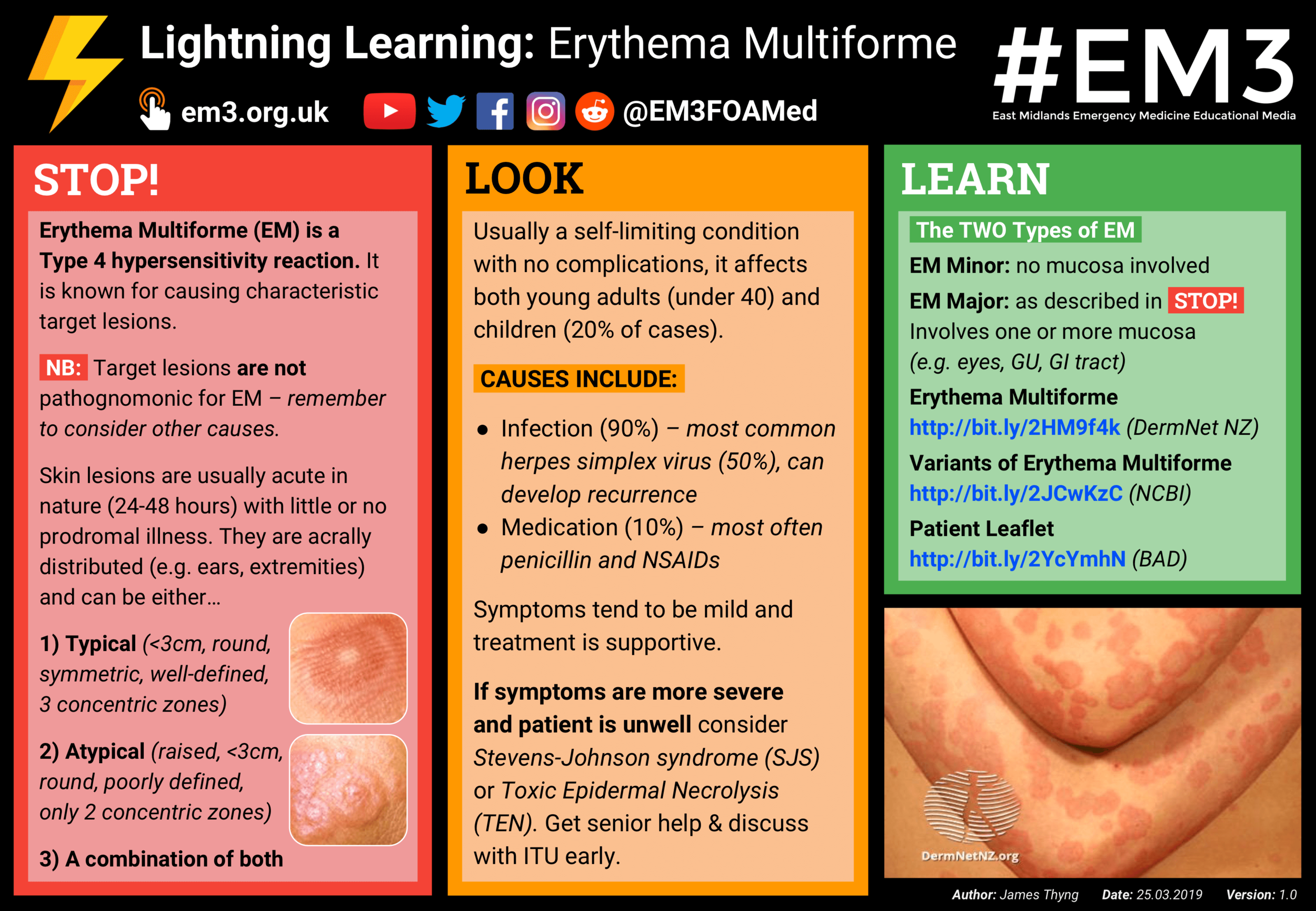Lightning Learning: Erythema Multiforme — EM3