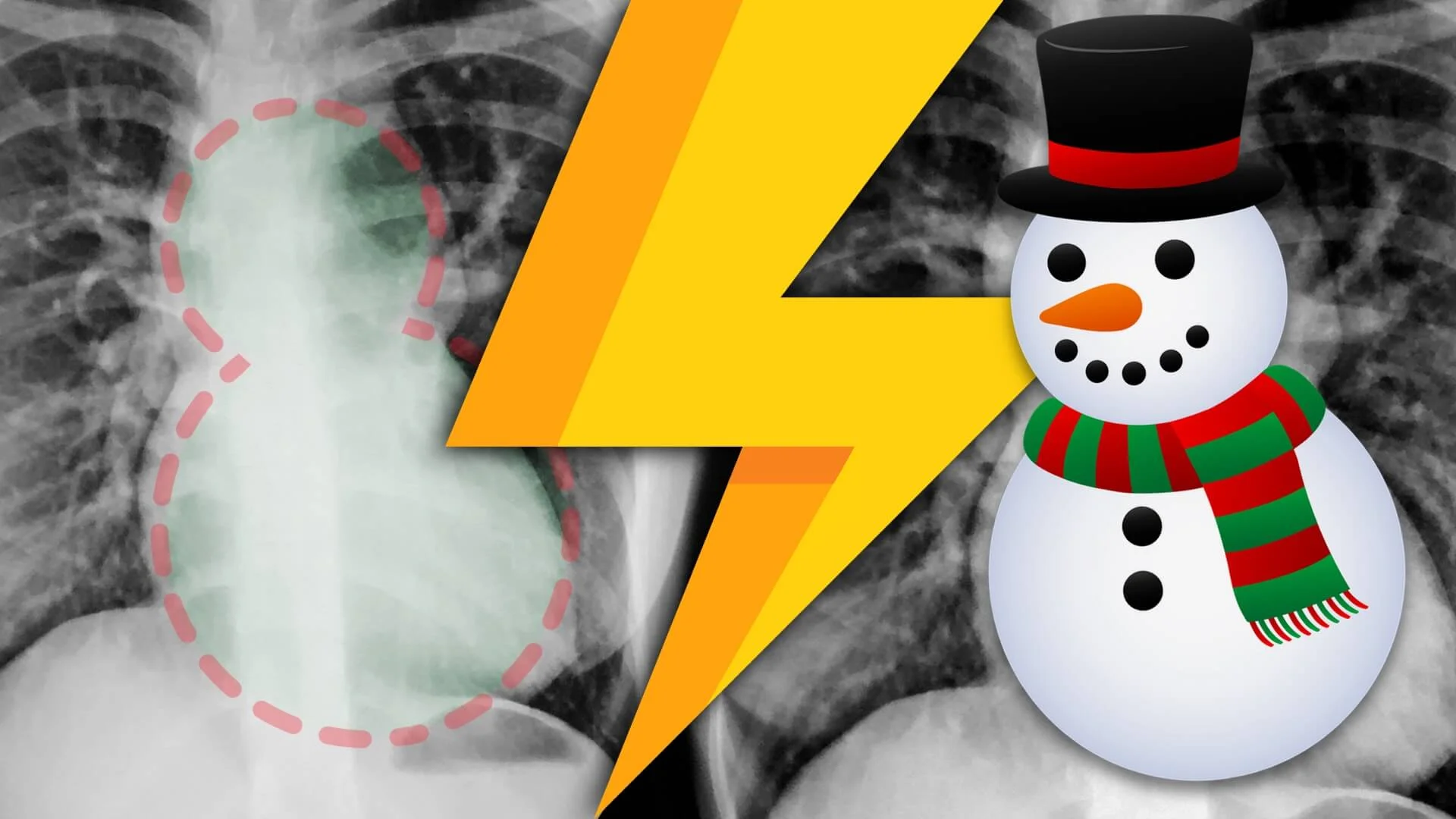 Lightning Learning: TAPVD — EM3