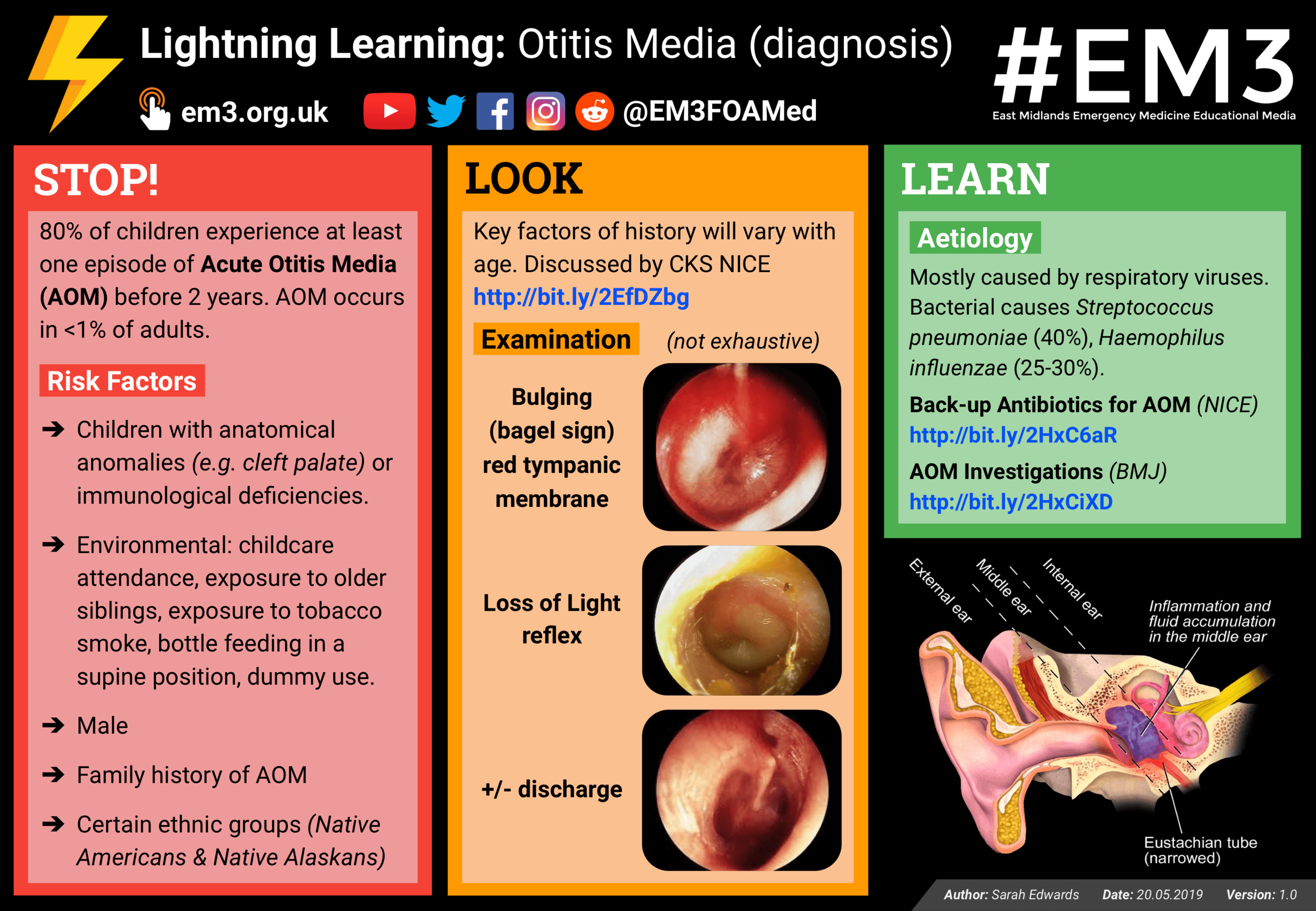 Lightning Learning Otitis Media Diagnosis And Management — Em3 East Midlands Emergency