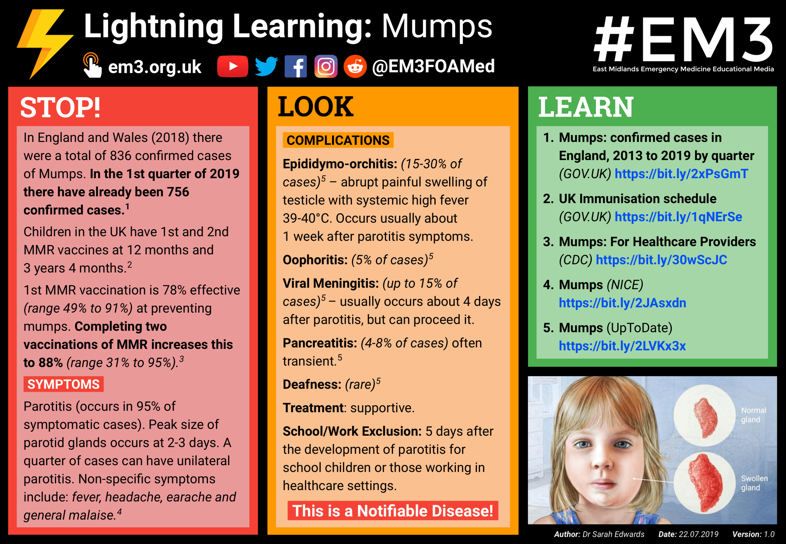 Lightning Learning: Mumps — EM3