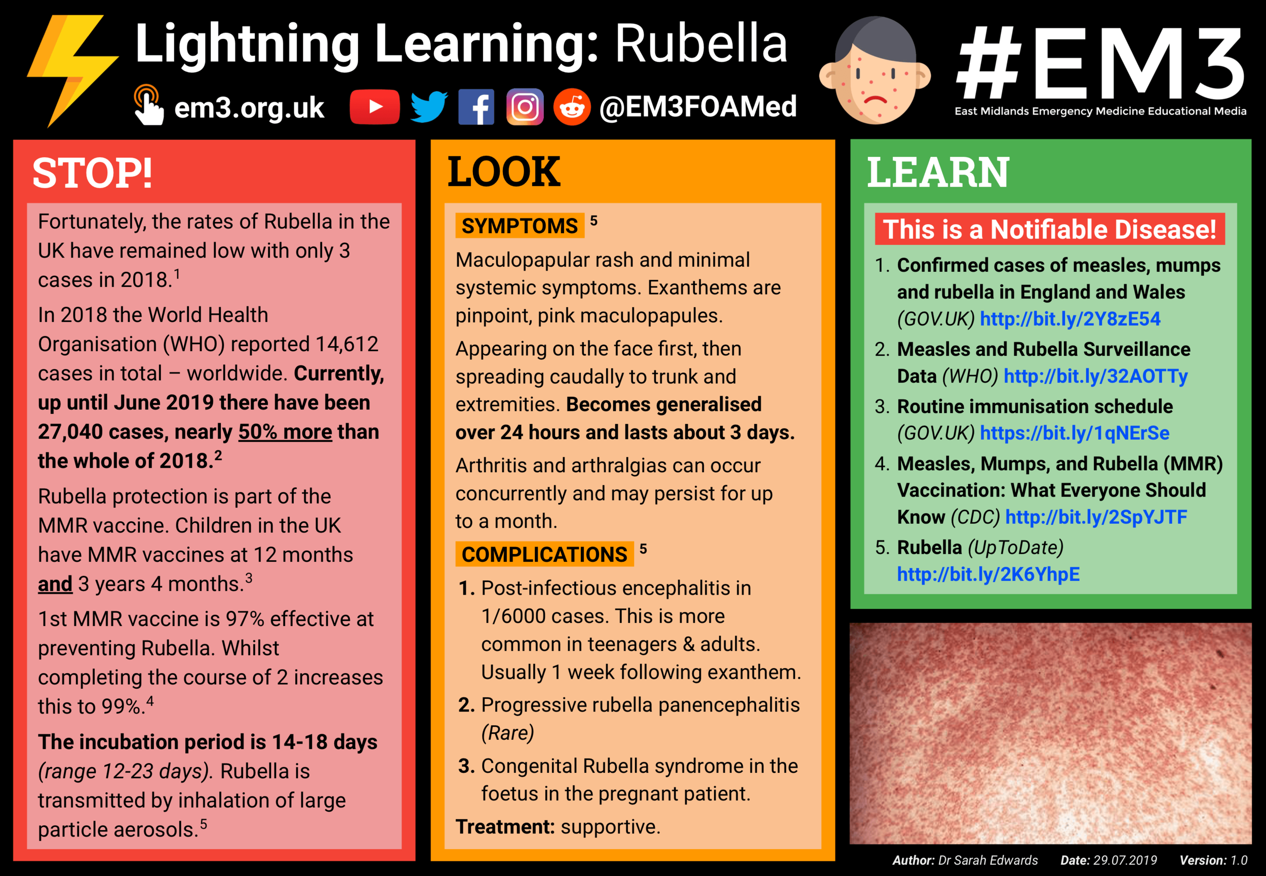 Lightning Learning: Rubella (aka German Measles) — #EM3: East Midlands ...