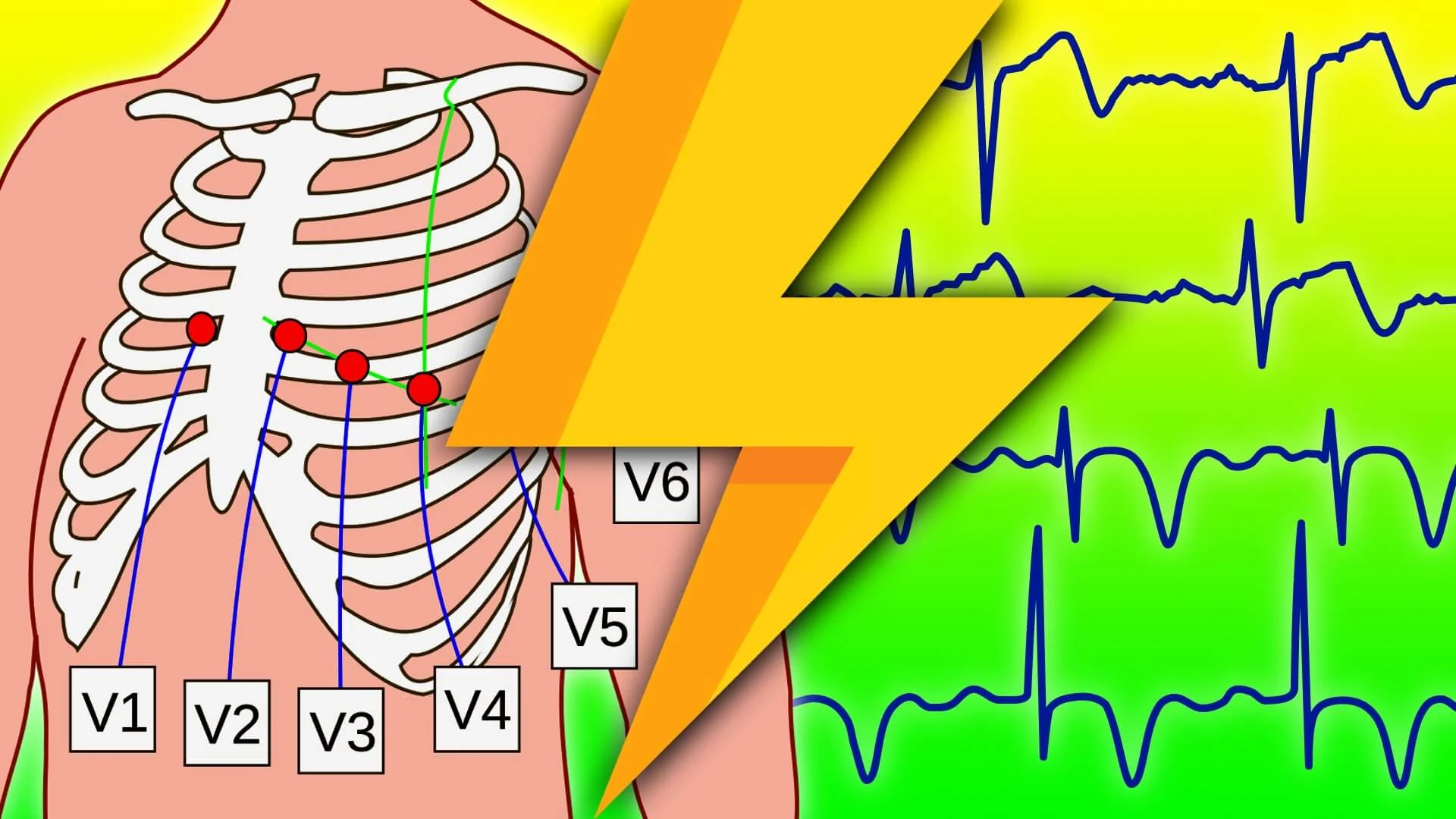 Lightning Learning: Osteomyelitis in Kids — EM3