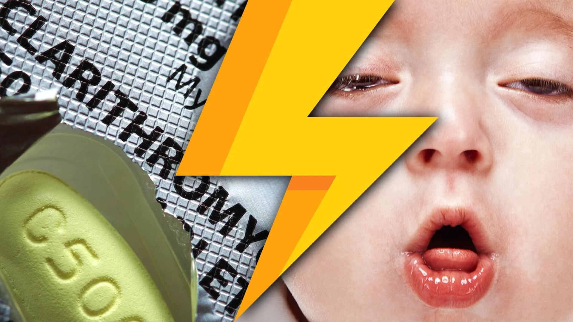 Lightning Learning: Steroids in Asthma — EM3