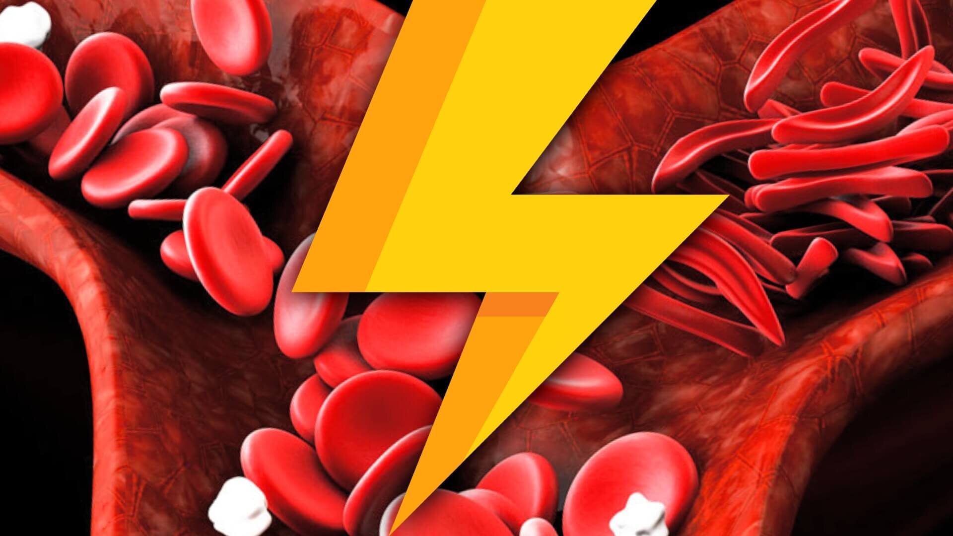 Lightning Learning: Sickle Cell Crisis — EM3