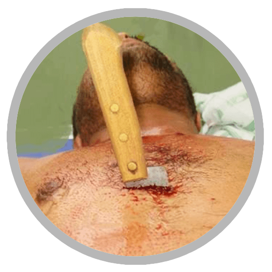 Resus Drills: Thoracotomy for Trauma — EM3