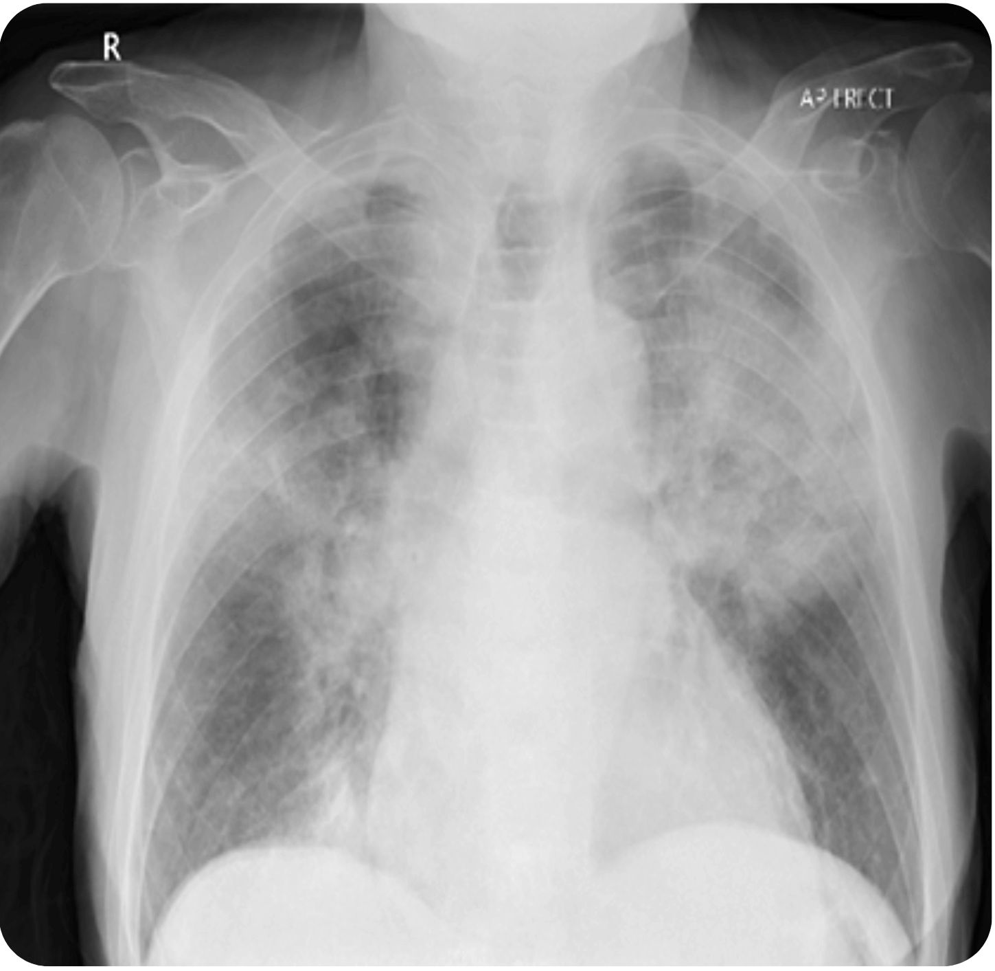 Adults Sim Scenario: COVID-19 — EM3