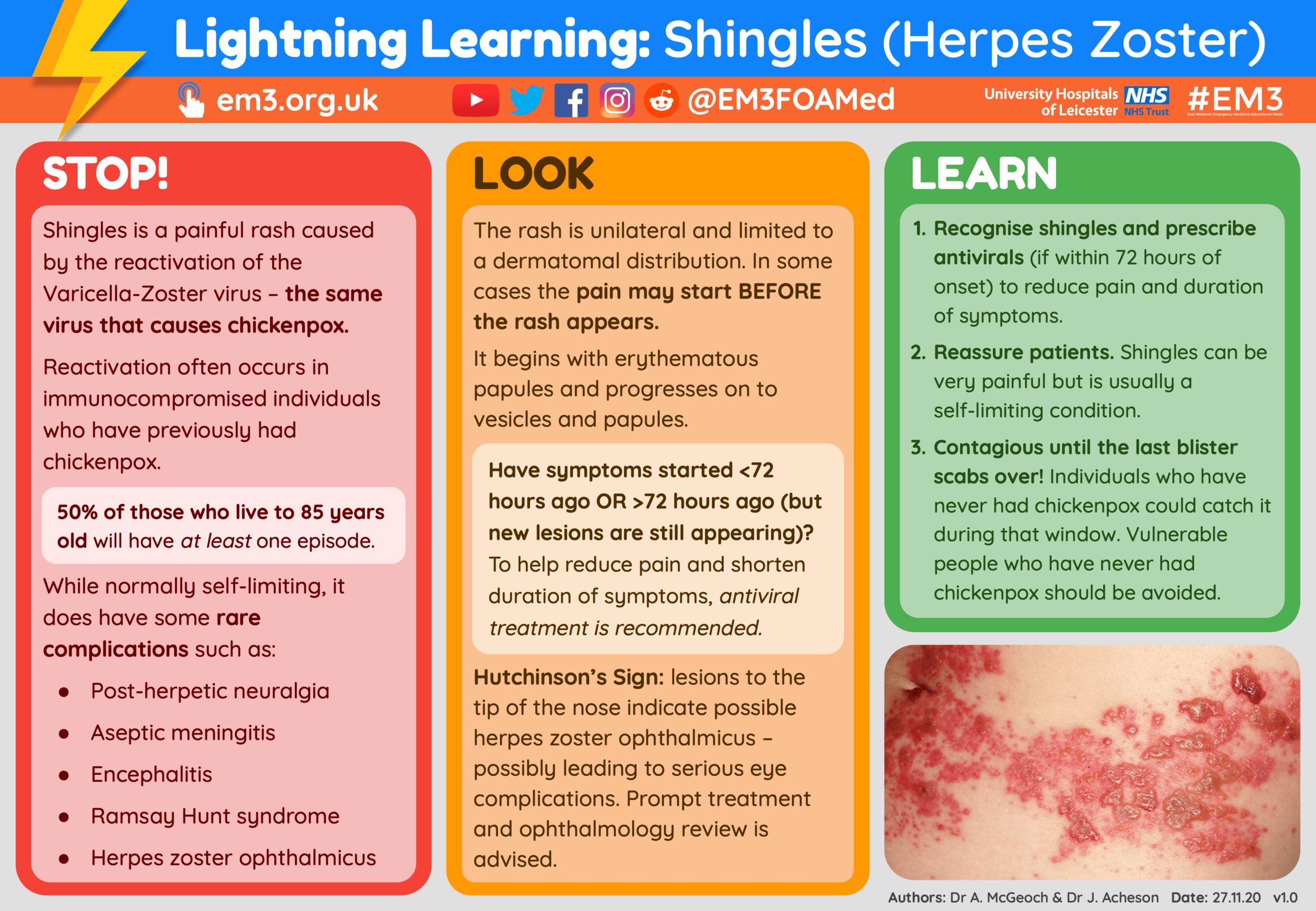 Lightning Learning: Shingles — EM3