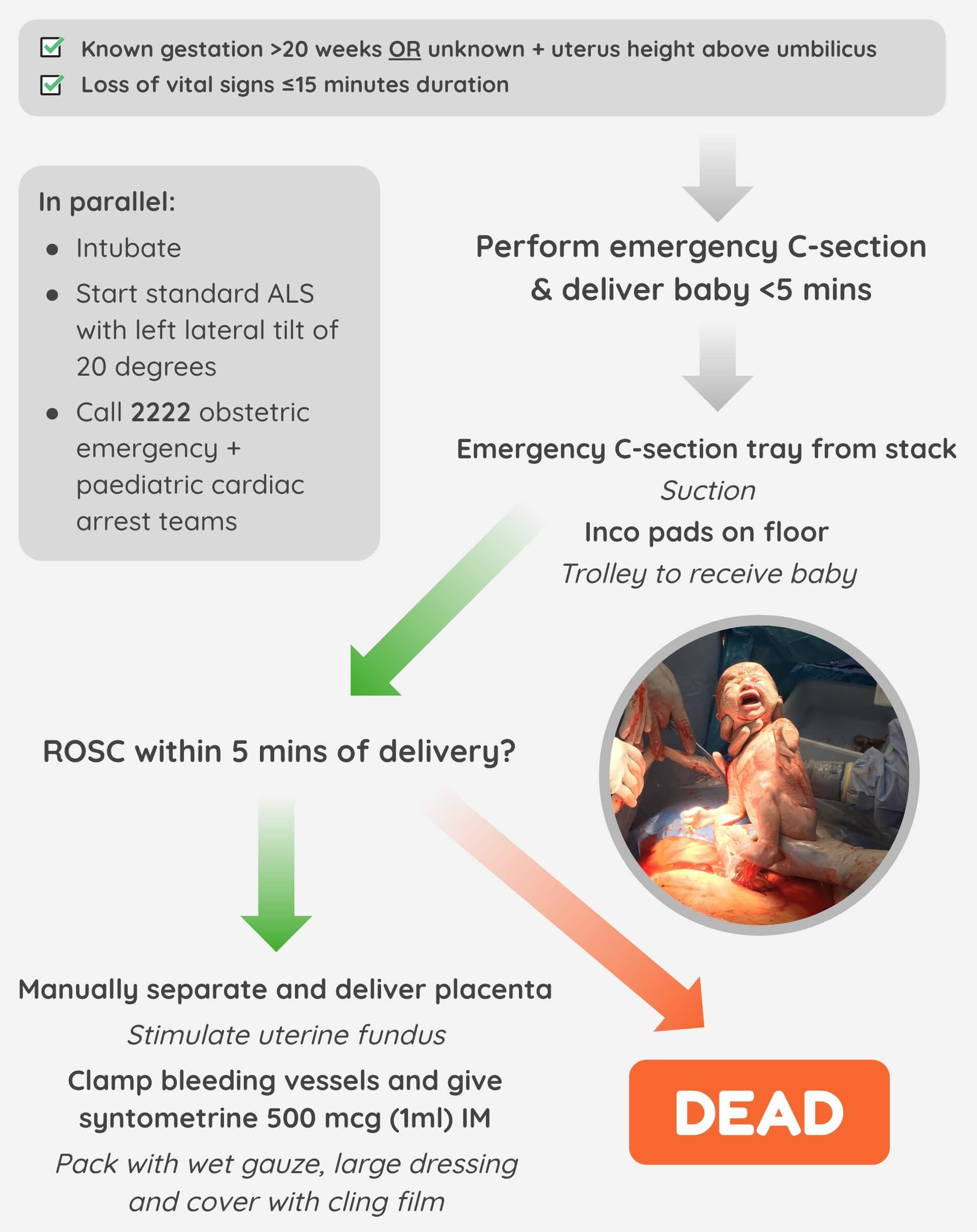 Resus Drills: Caesarean Section — EM3