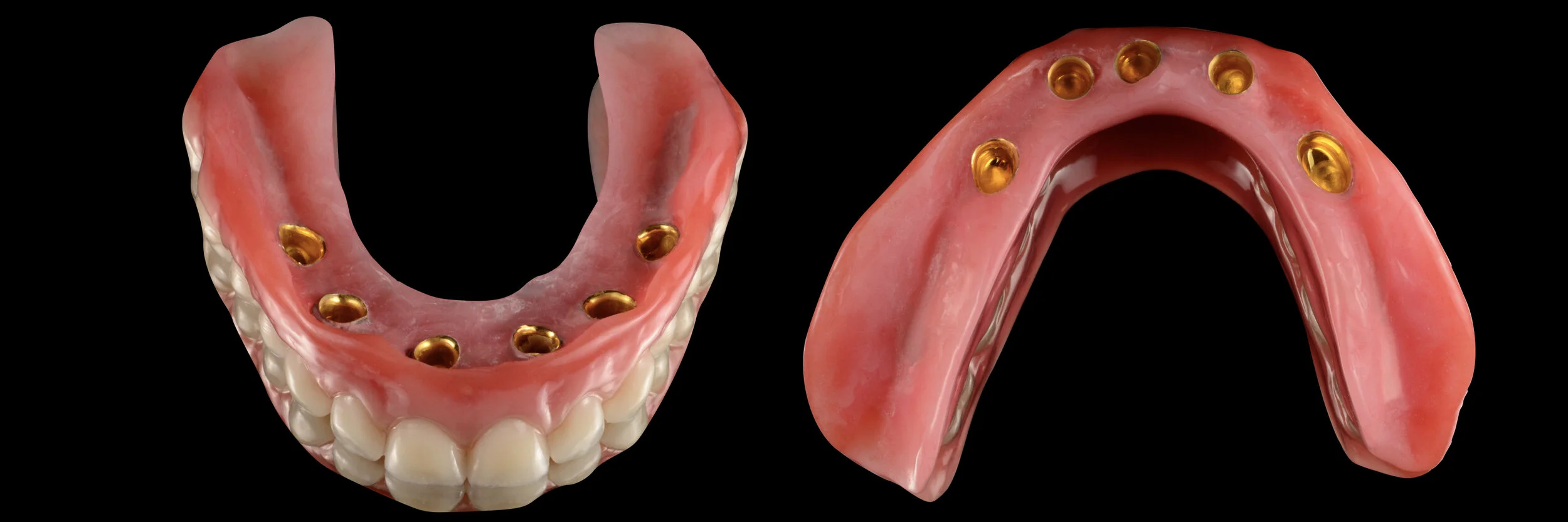 Products — Deutsch Dental Arts