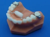 Appliances — Water Oak Dental Laboratories