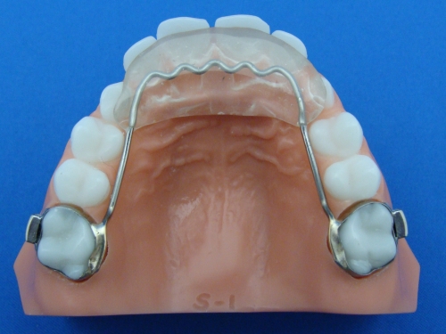 Appliances — Water Oak Dental Laboratories