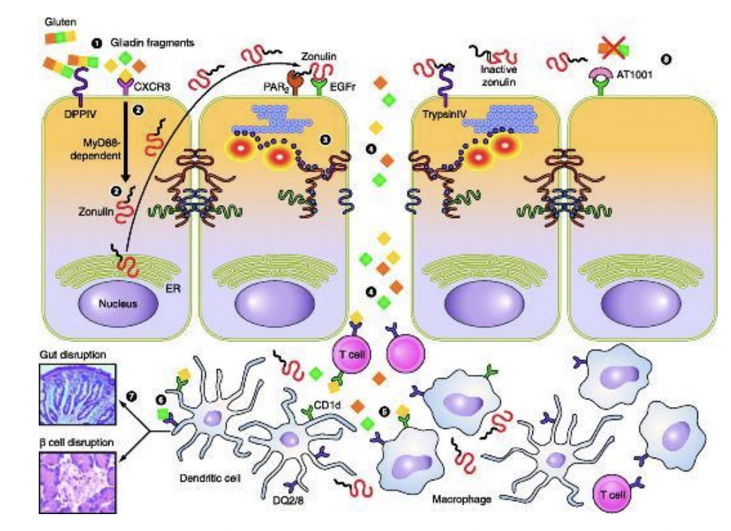 Zonulina fecal detecta hiperpermeabilidade intestinal — ANDREIA TORRES