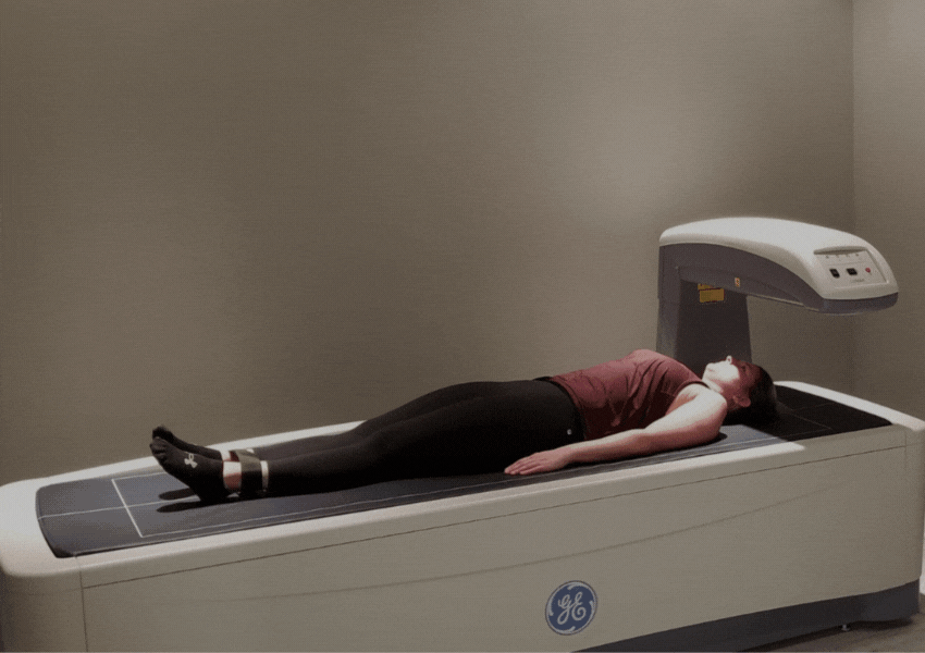 Unveiling the Hidden Link Between Rheumatoid Arthritis, Osteoporosis ...