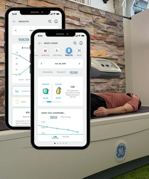 Dexa (DXA) Scans | Body Fat Testing | DexaFit