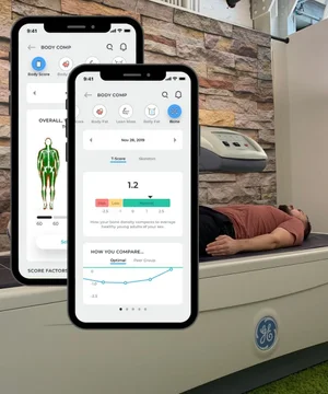 DEXA Scan Bone Density Test