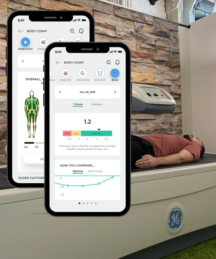 DEXA Scan Bone Density Test