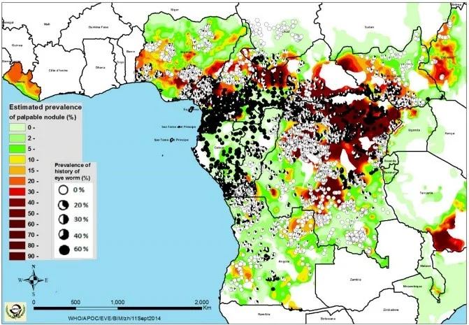Loiasis — Drugs & Diagnostics for Tropical Diseases