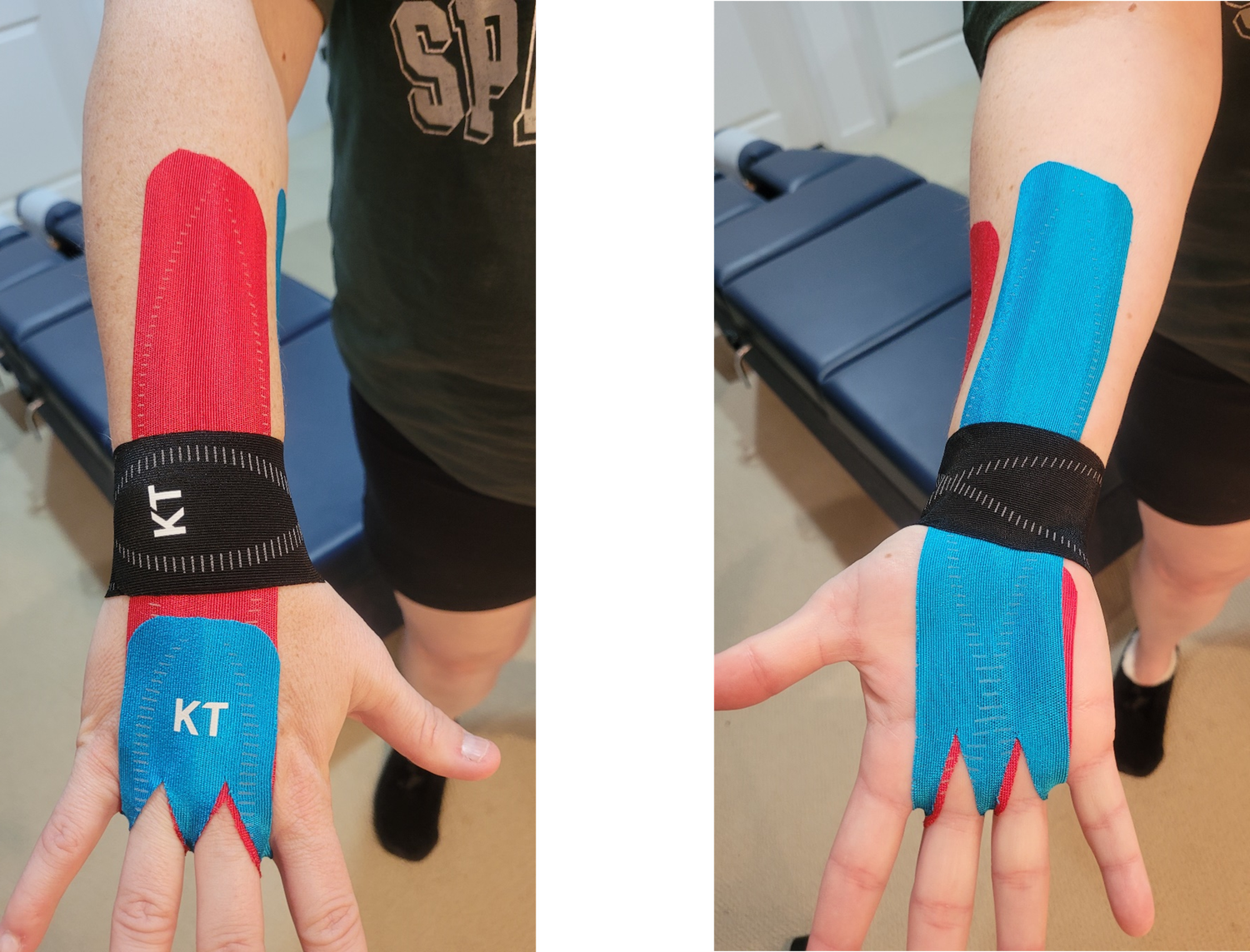 Treating Common Sports Injuries — Fetterman Events