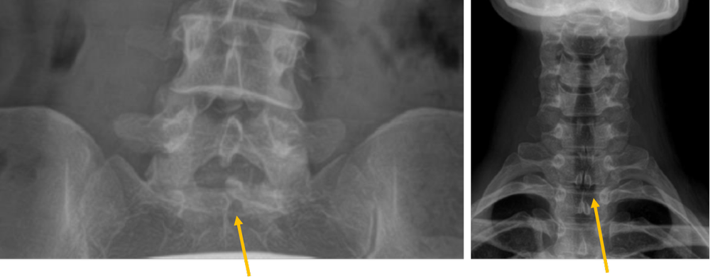 Case Studies with Dr. Yochum — Fetterman Events