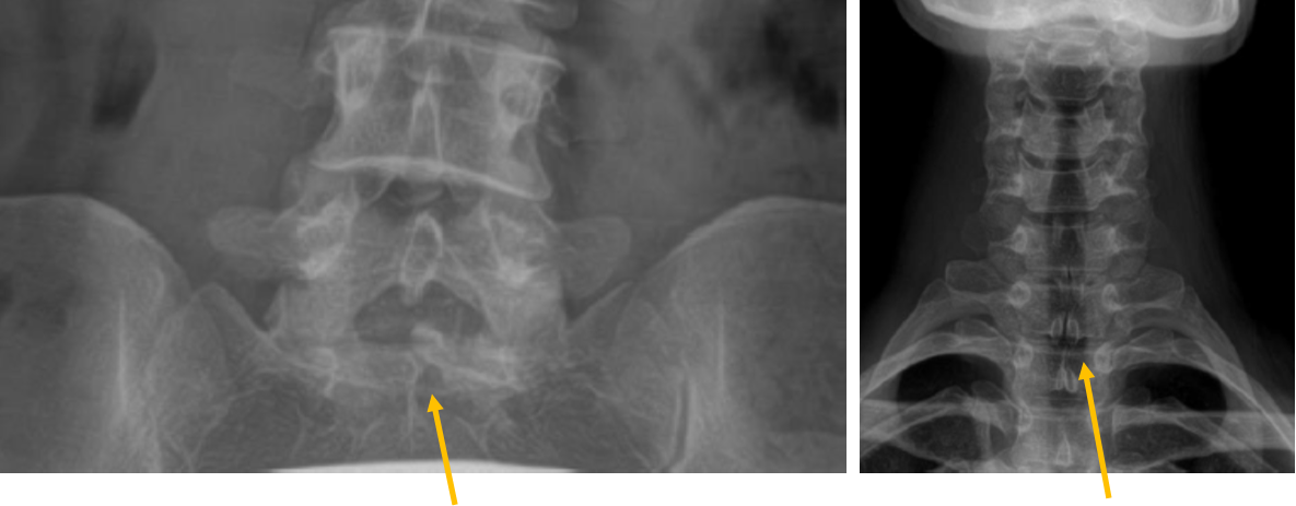 Case Studies with Dr. Yochum — Fetterman Events