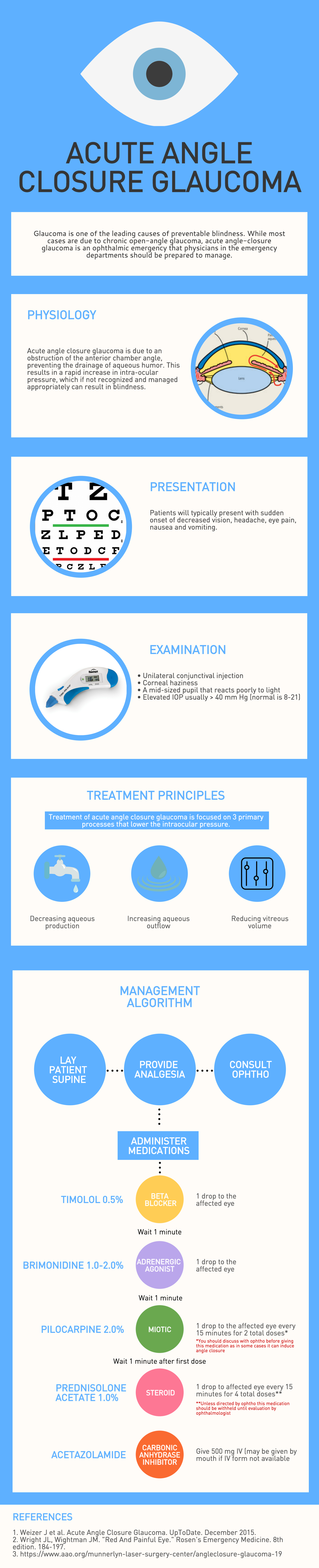 A Visual Guide to Acute Angle Closure Glaucoma — NUEM Blog