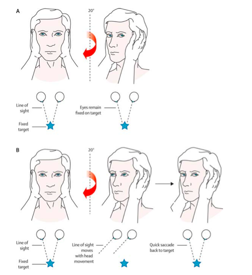 Vertigo A Hint On The Hints Exam Nuem Blog