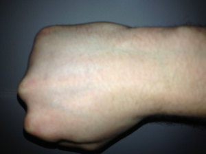 Demystifying the Hand Exam — NUEM Blog
