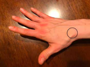 Demystifying the Hand Exam — NUEM Blog