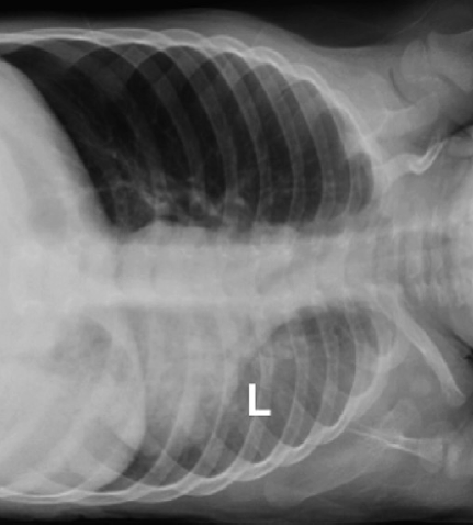 A Deep "Seeded" Cough — NUEM Blog