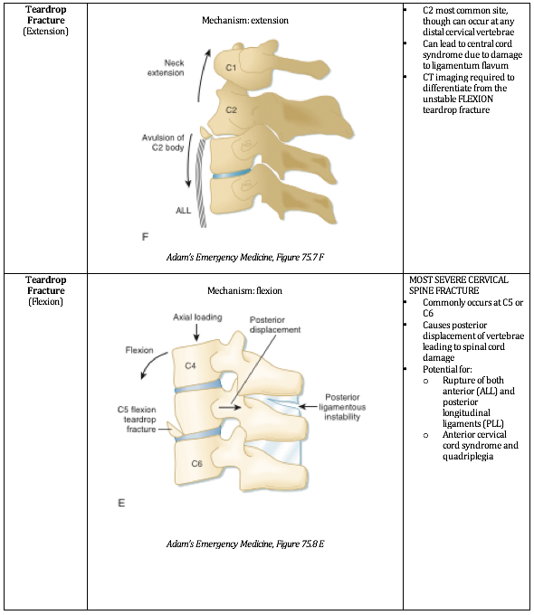 Unstable Cervical Spine Fractures — NUEM Blog