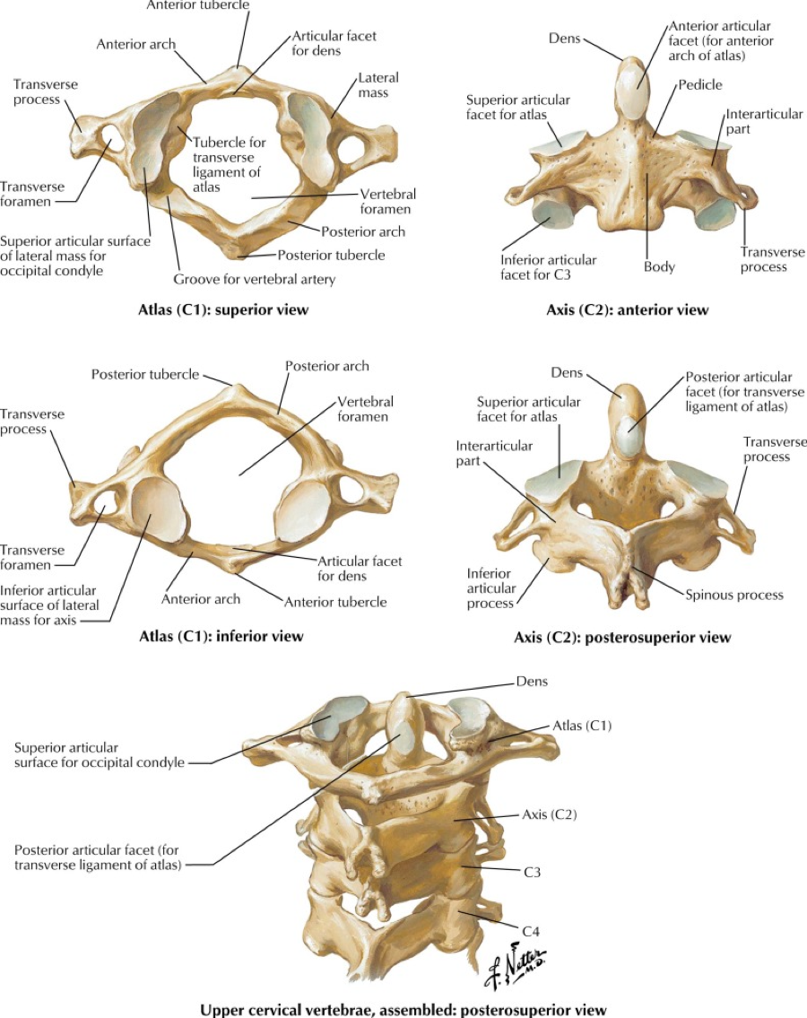 Unstable Cervical Spine Fractures — NUEM Blog