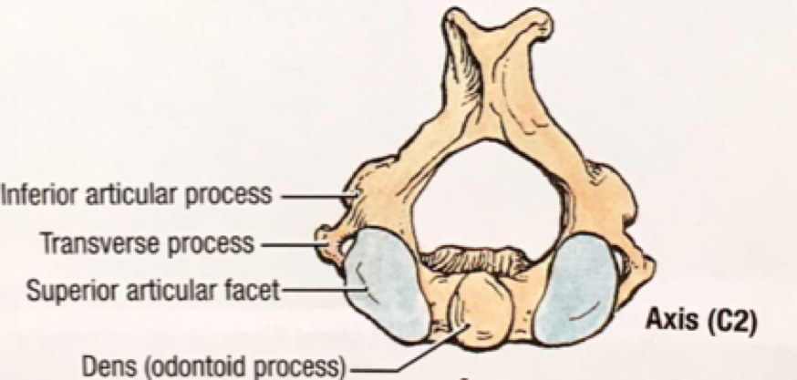 Unstable Cervical Spine Fractures — NUEM Blog