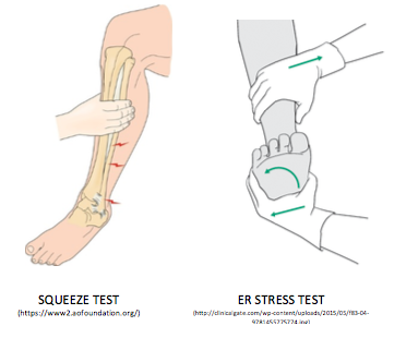 Not All Ankle Sprains are Created Equal — NUEM Blog