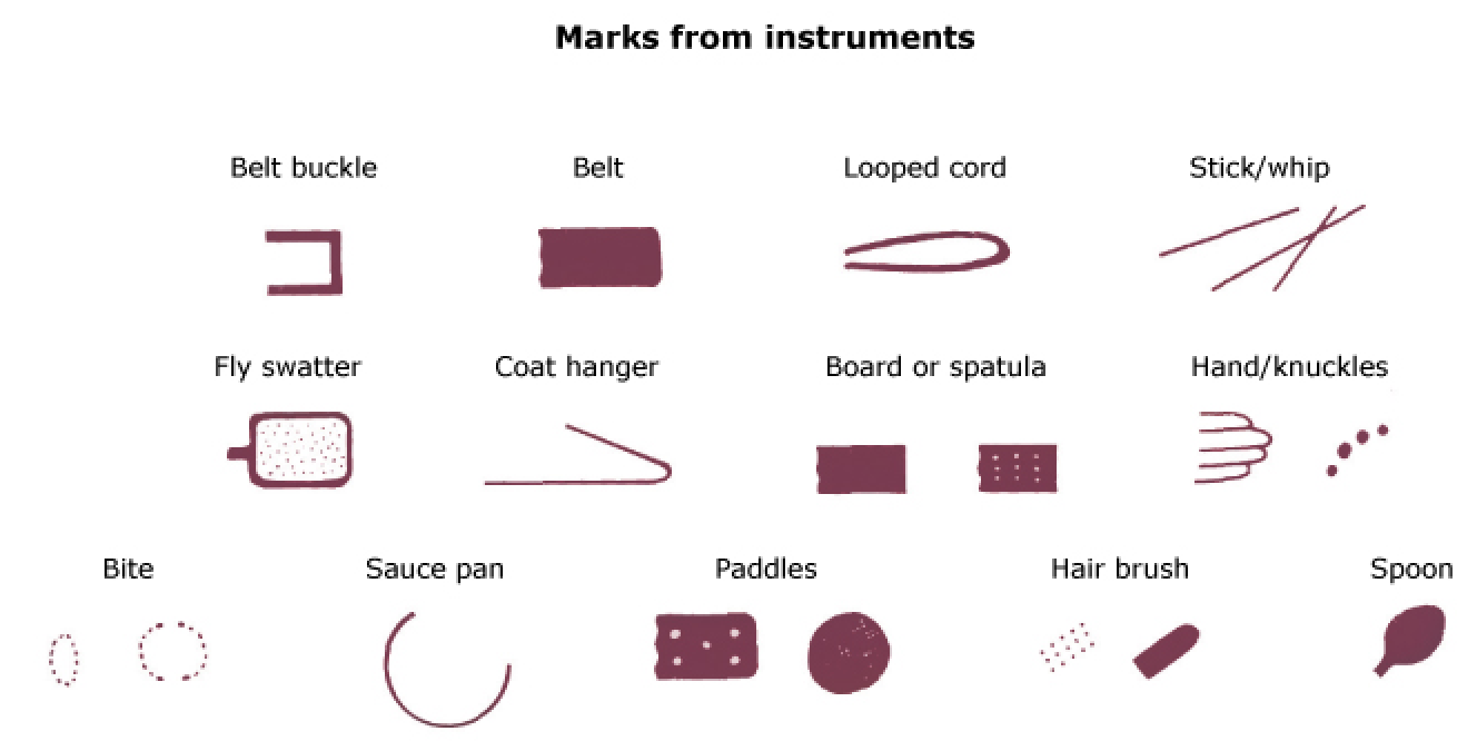 Non-Accidental Trauma - A Can’t Miss Diagnosis — NUEM Blog