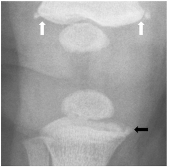 Non-Accidental Trauma - A Can’t Miss Diagnosis — NUEM Blog