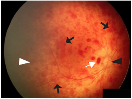 Non-Accidental Trauma - A Can’t Miss Diagnosis — NUEM Blog