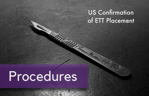Ultrasound Confirmation of Endotracheal Tube Placement — NUEM Blog