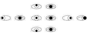 Approach to Double Vision in the ED — NUEM Blog