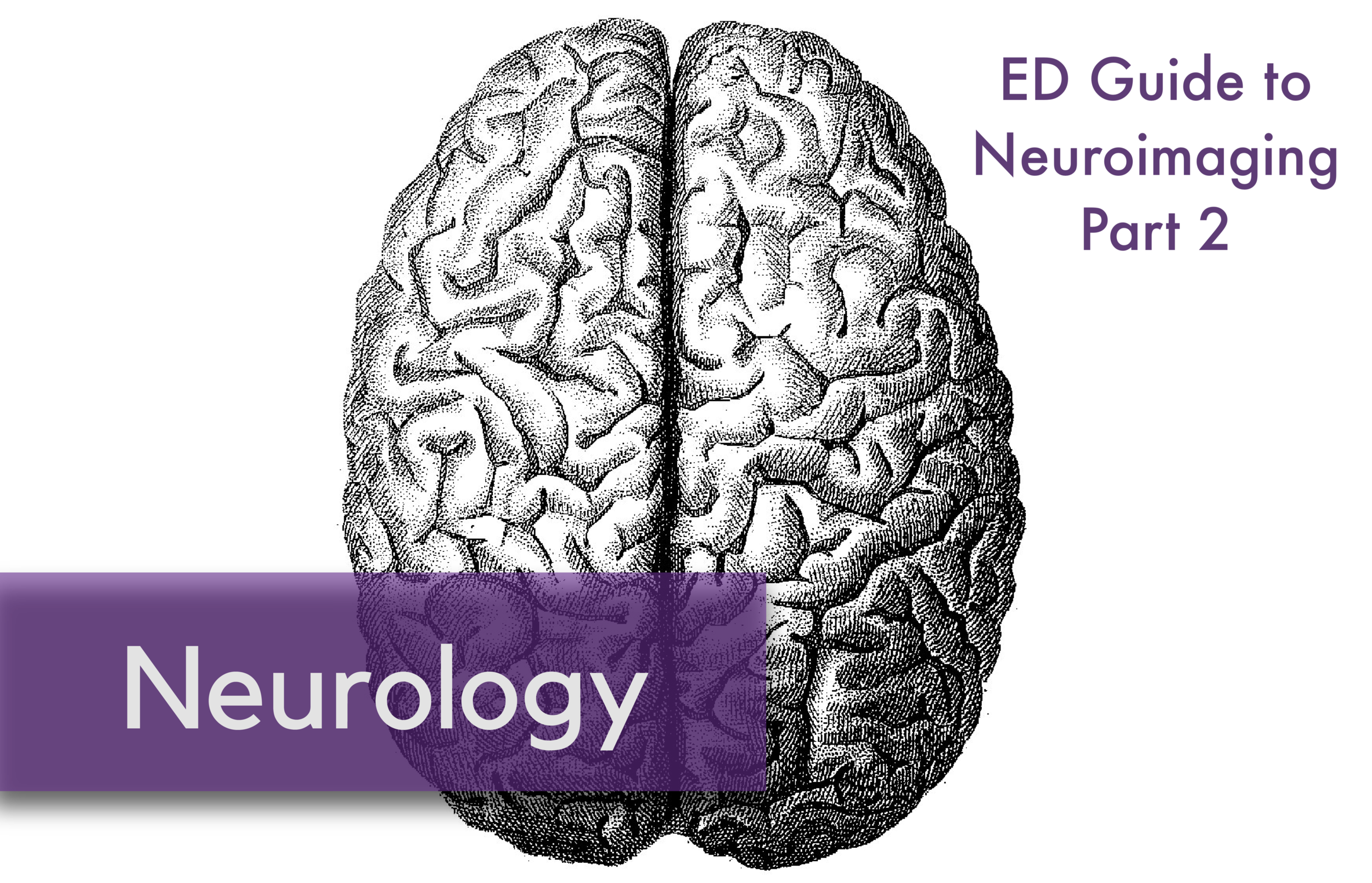 The ED Guide to Neuroimaging: Part 2 — NUEM Blog