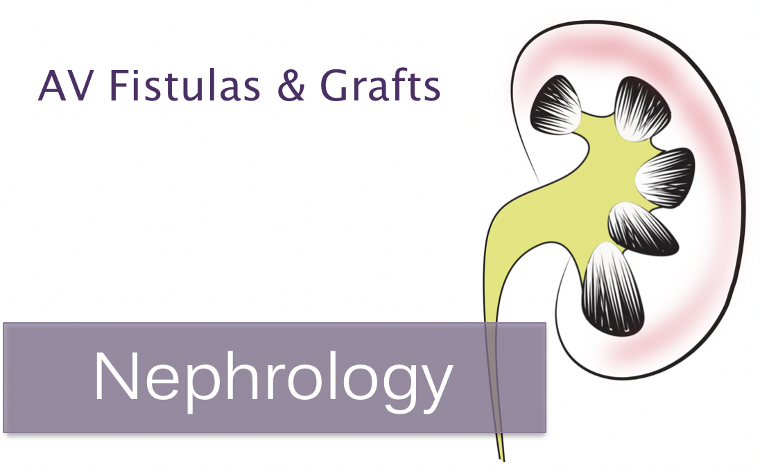 AV Fistulas and Grafts — NUEM Blog AV Fistulas and Grafts — NUEM Blog