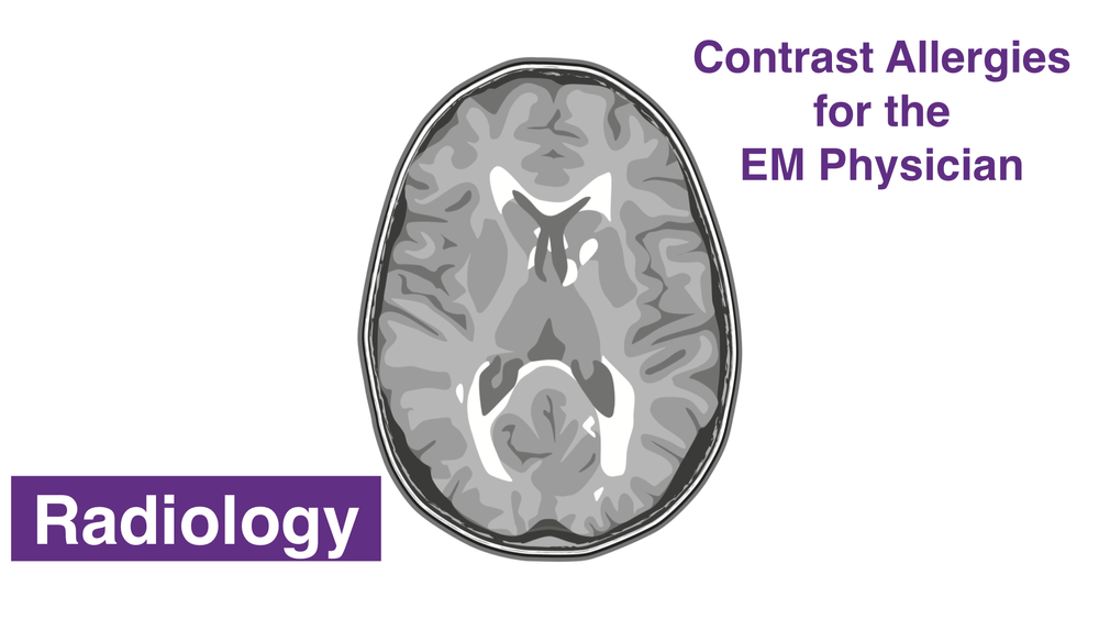 Contrast Allergies for the Emergency Medicine Physician — NUEM Blog