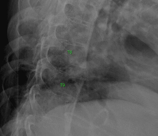 MVC — Ortho Teaching Files — NUEM Blog