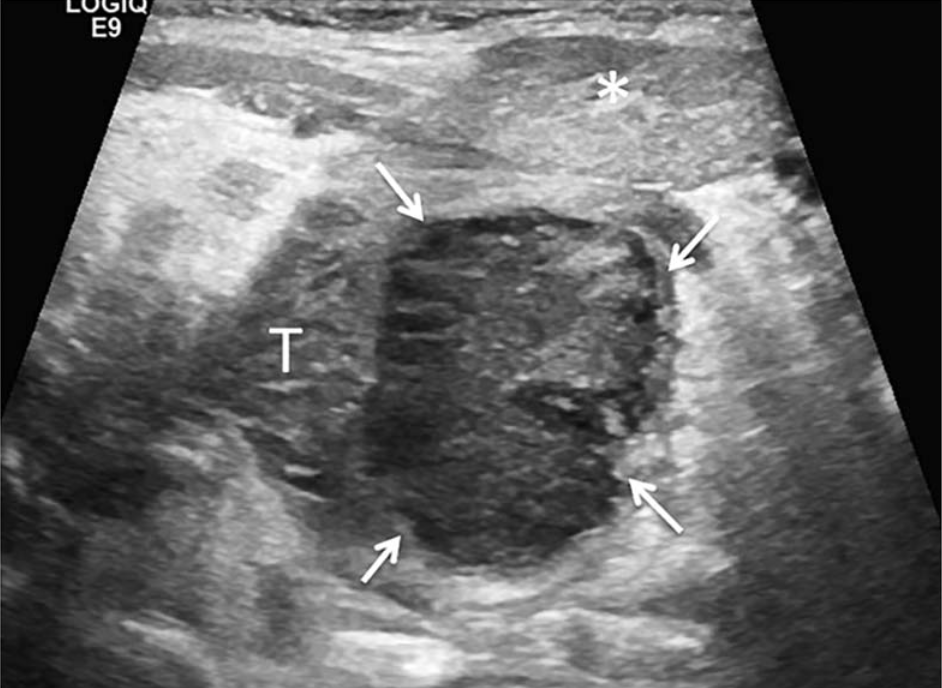 Imaging in PTAs — NUEM Blog