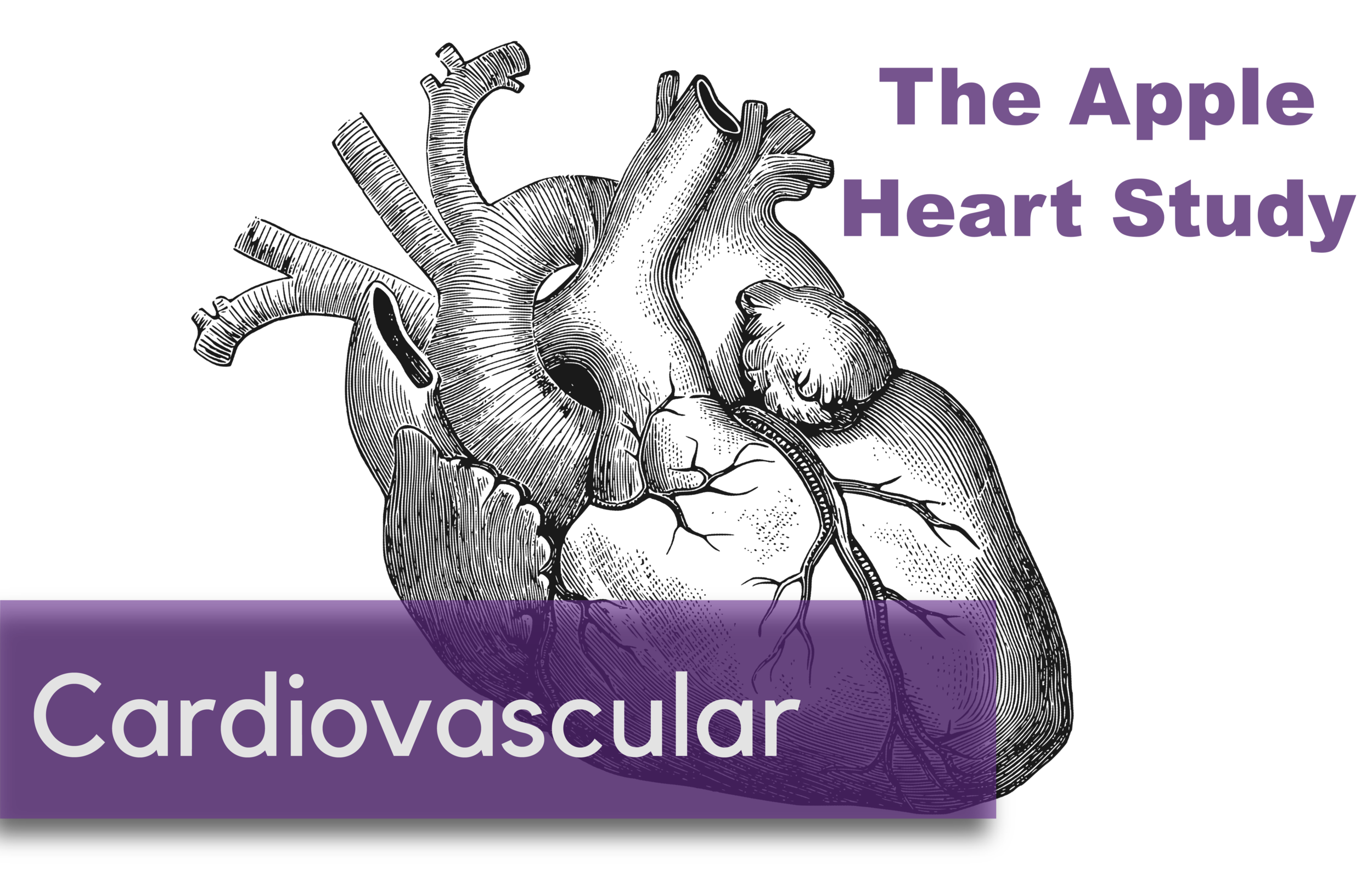 Apple Heart Study — NUEM Blog